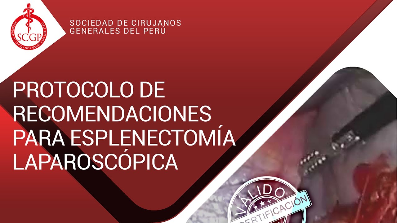 PROTOCOLO DE RECOMENDACIONES PARA ESPLENECTOMÍA LAPAROSCÓPICA - YouTube
