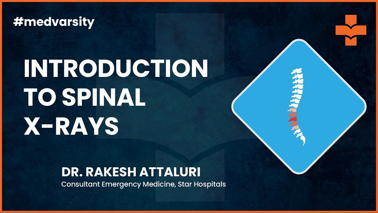Introduction to Spinal X-Rays | Medical Case Discussion - YouTube
