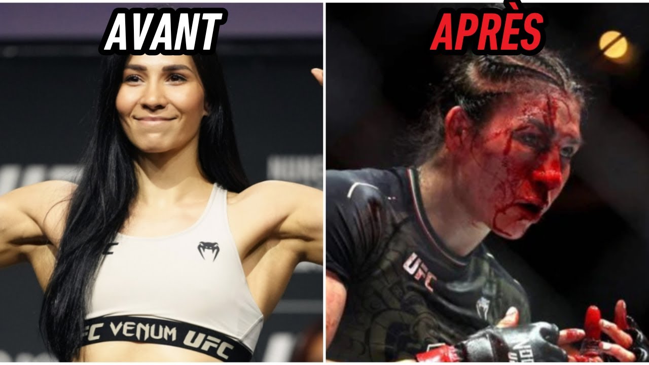 UFC 306 : Terrible Blessure d'Irene Aldana au Visage ! - YouTube