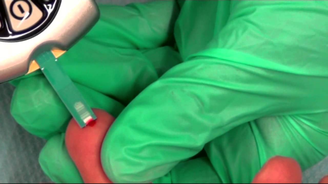 Stick glicemico - YouTube