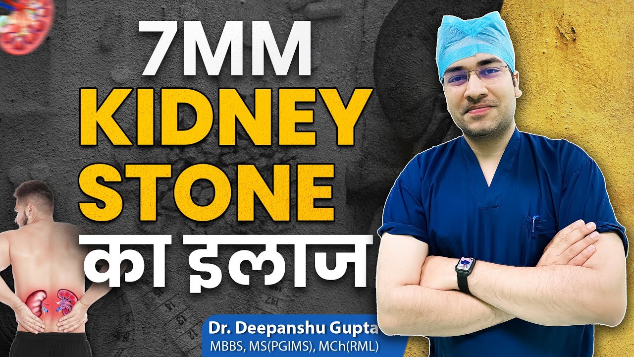 7mm Kidney Stone Kaise Nikalein? | Fast & Painless Treatment Explained - YouTube