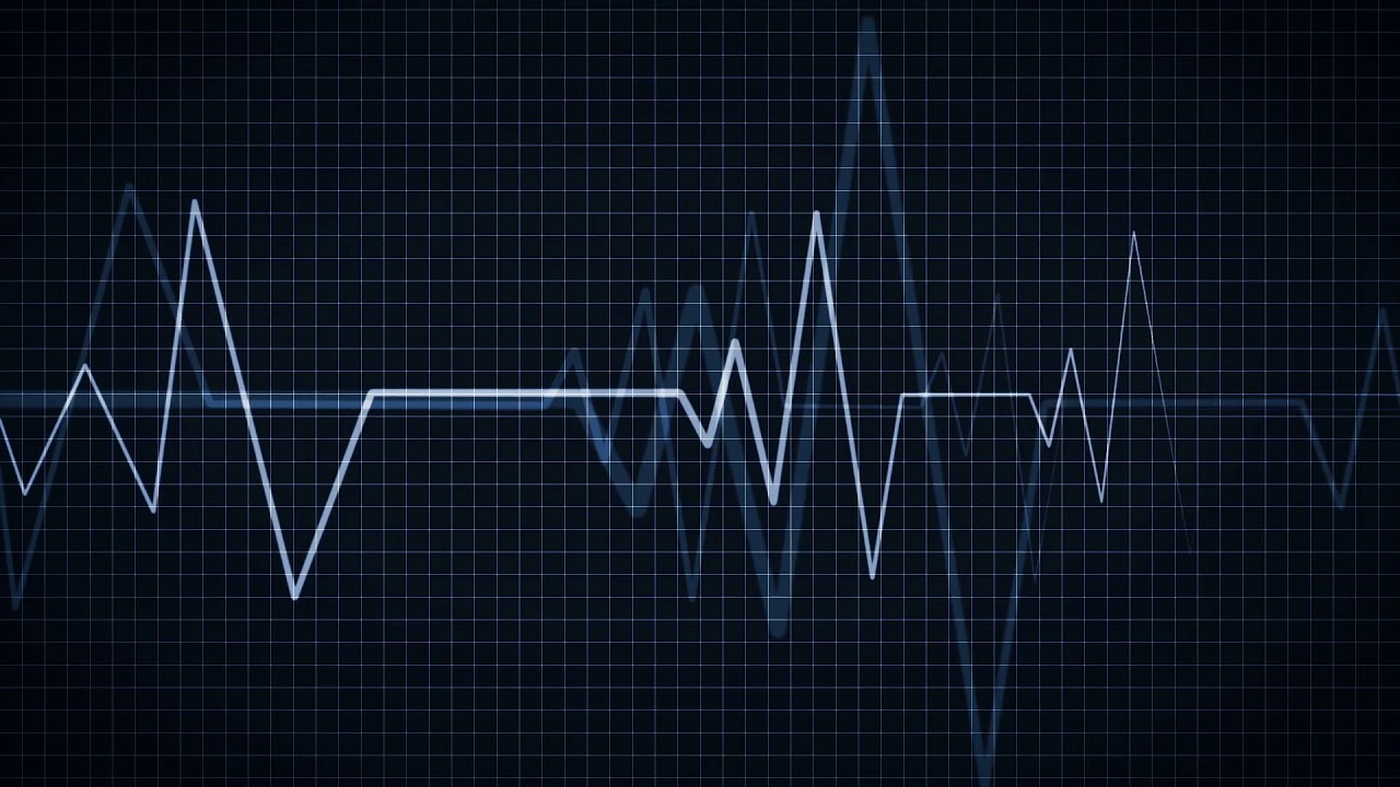 Heartbeat Sound Sample (Zero Motion) - YouTube