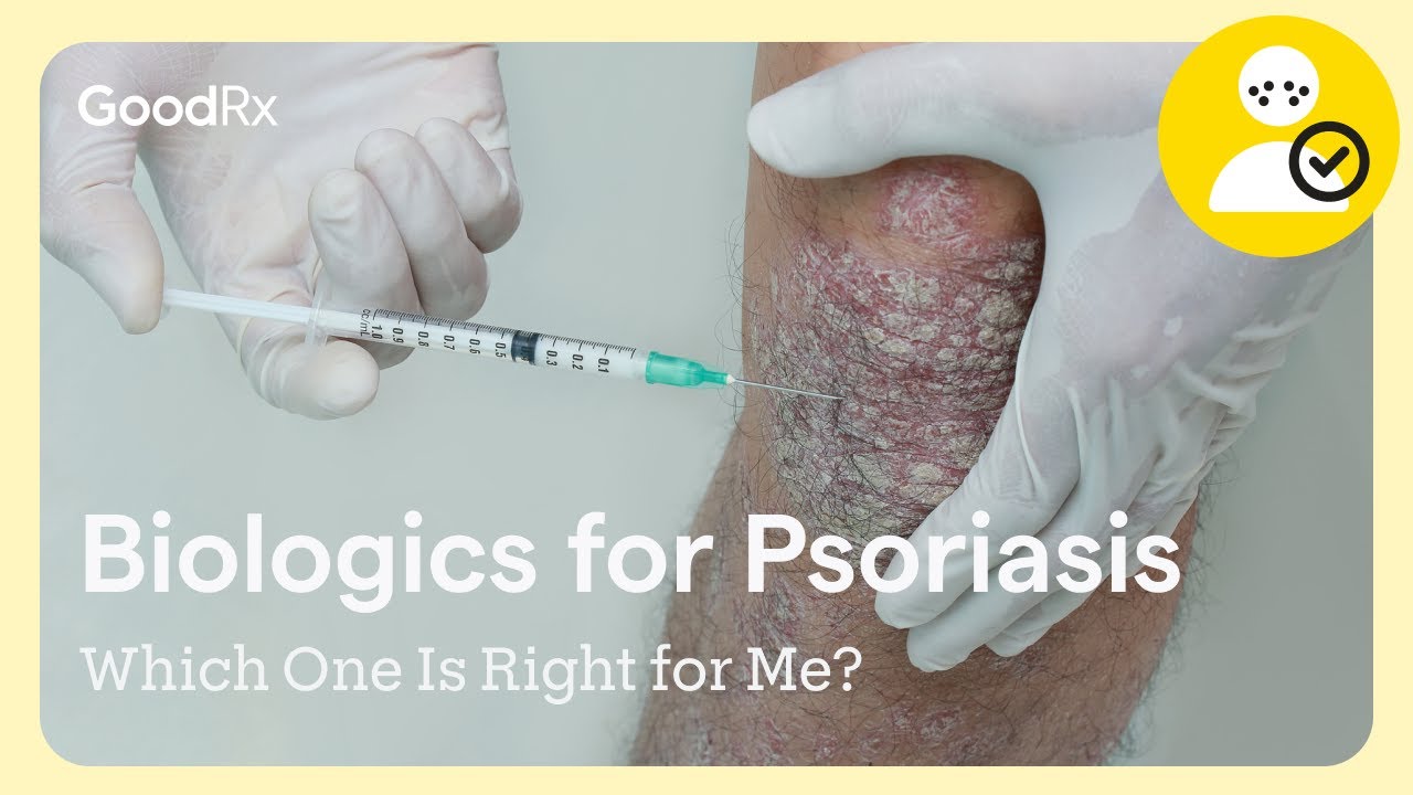 Choosing a Biologic for Psoriasis: Which One Is Right for Me? | GoodRx ...
