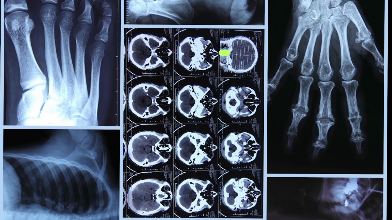 ¿Qué son los Rayos X?. Laboratorios Chong San Luis Potosí - YouTube