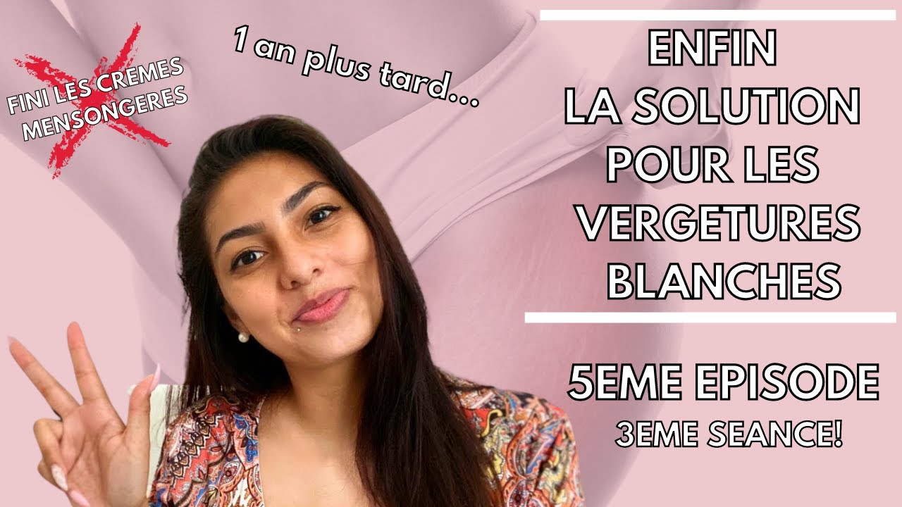 3ème séance : CAMOUFLAGE DES VERGETURES BLANCHES ⚡ - YouTube