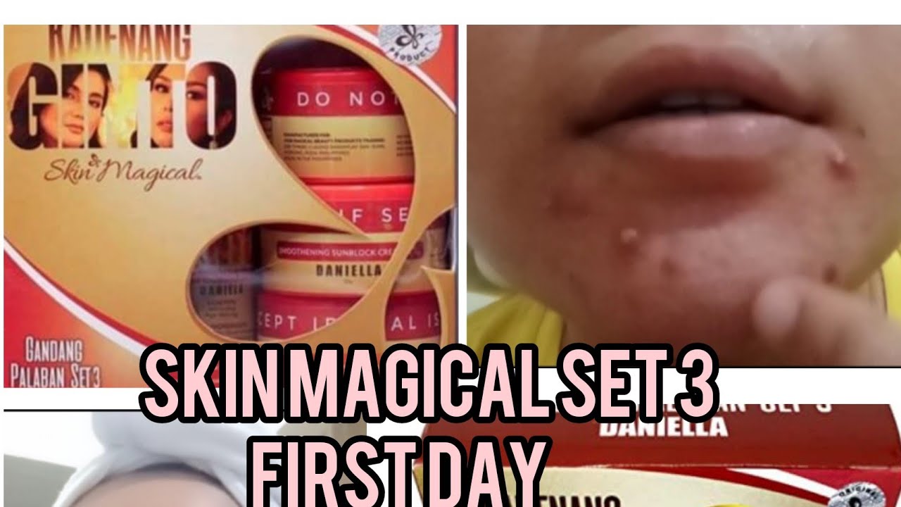 Skin magical set 3 - YouTube