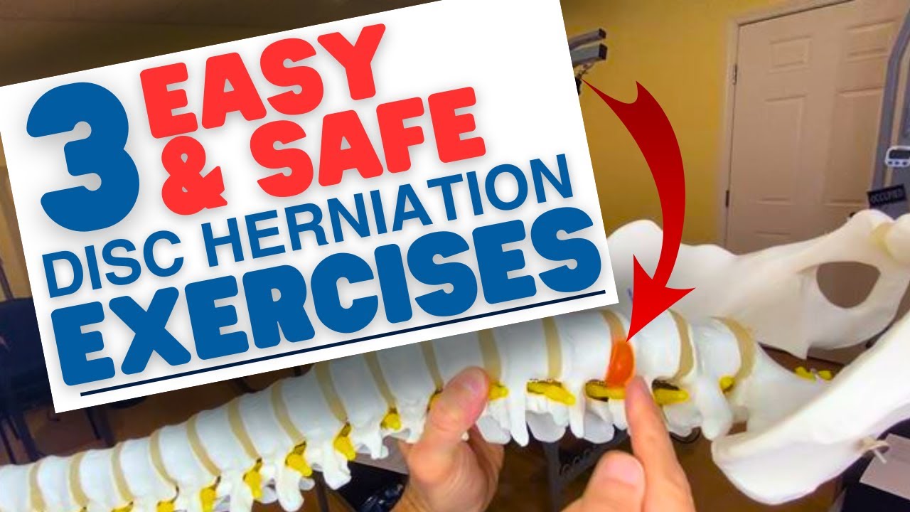 3 EASY & SAFE L5-S1 Disc Herniation Exercises (& L4-L5 )| Dr. Marc ...