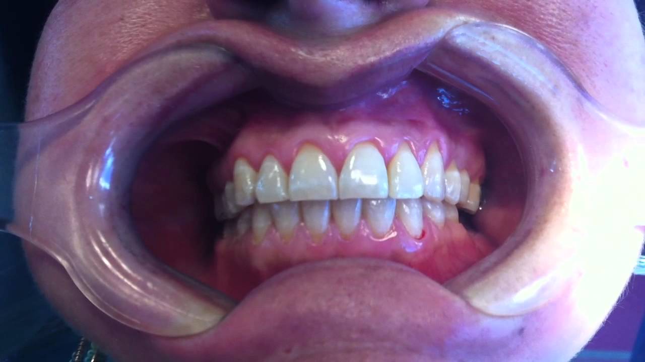 Protrusiva - YouTube