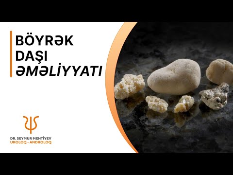 Dr.Seymur Mehtiyev - Böyrək Daşı Əməliyyatı