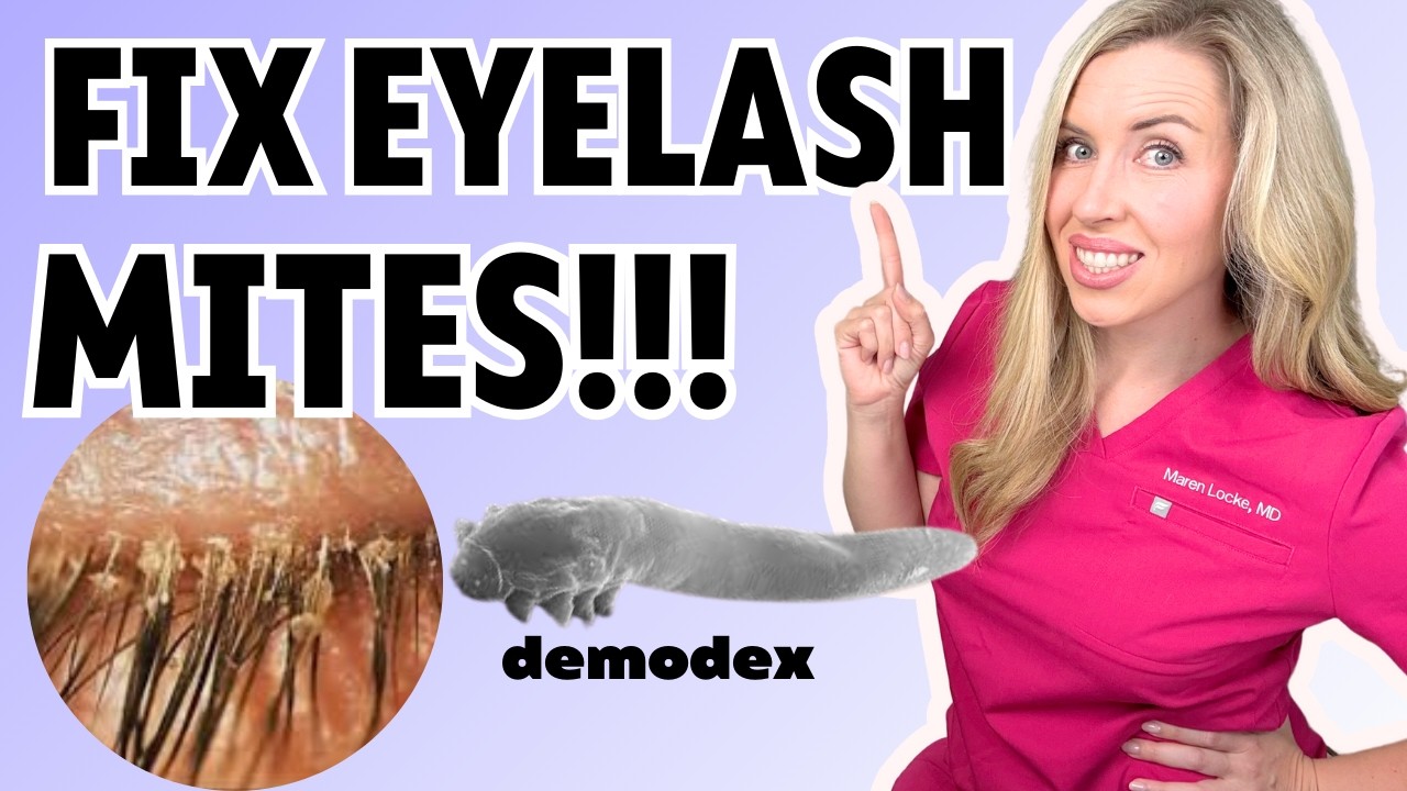 3 Drugstore Products To Fix Eyelash Mites! | Demodex Explained by The ...