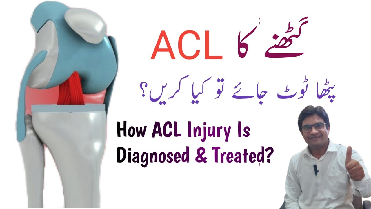 How ACL Injury Is Diagnosed And Treated | ACL Reconstruction| Dr Arshad ...