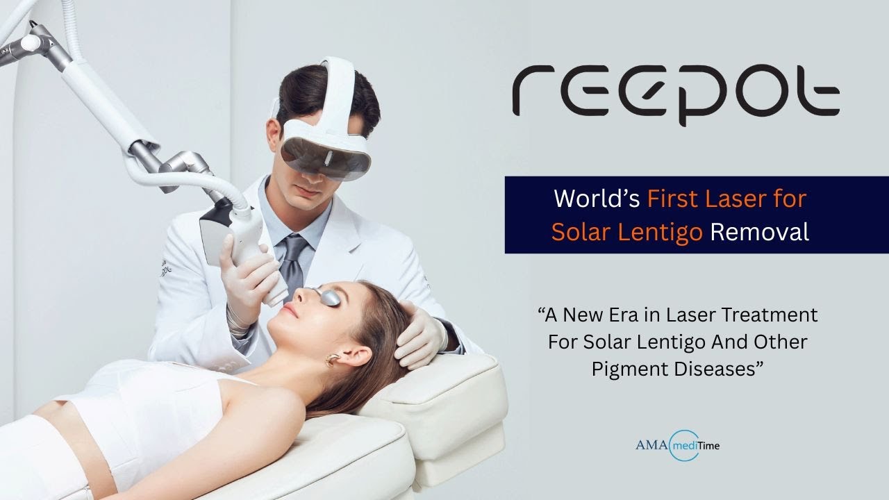 reepot | World's First Laser for Solar Lentigo Removal - YouTube