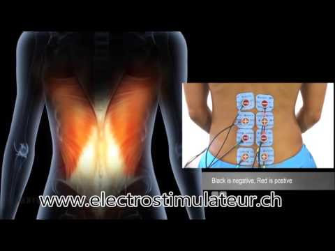 Placement et Position Electrode Compex Lombalgie et Lumbago | StenUp