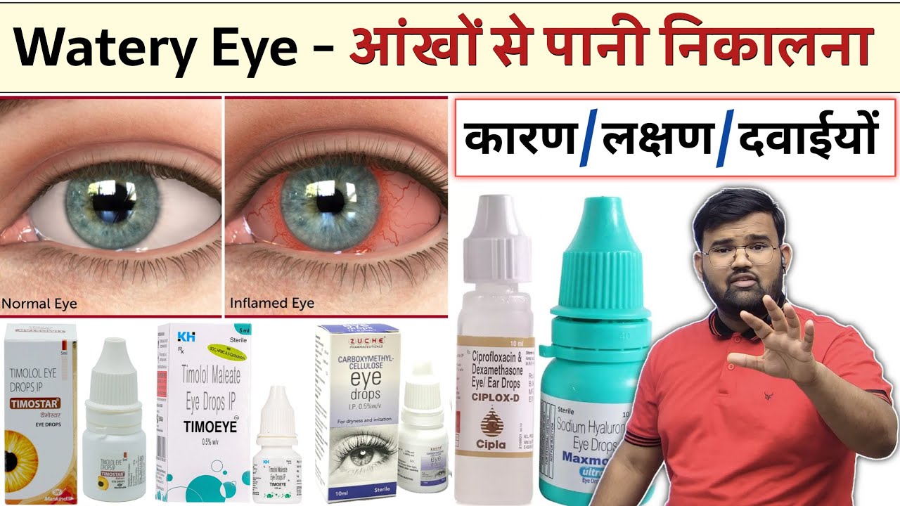 आंखों से पानी निकलना | Epiphora | Watery Eye | Eye Infection | Eye Drop ...