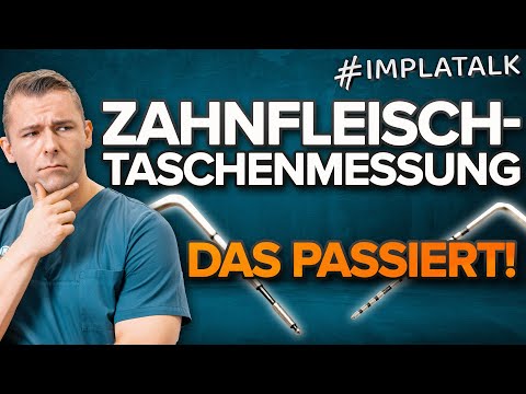 Zahnfleischtaschen messen: Was sagen PSI und Parodontalstatus aus?