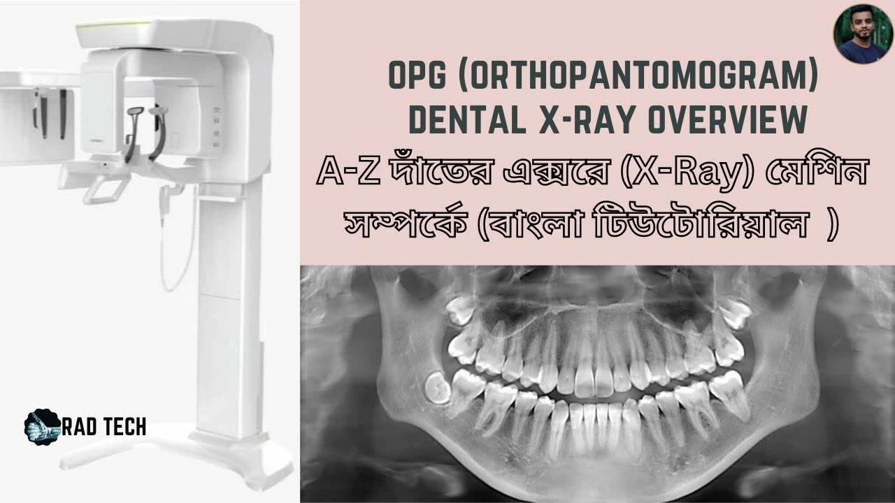 OPG (Orthopantomogram) | Dental X-Ray Machine Overview | Vatech OPG ...