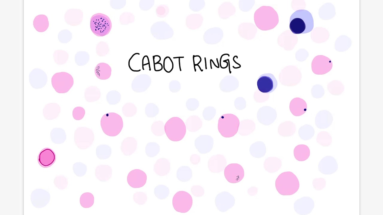 Cabot ring inclusions - YouTube