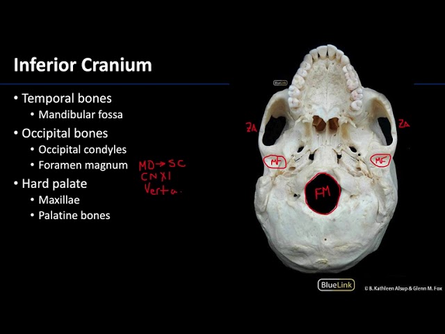 Maxillary Bone Inferior View