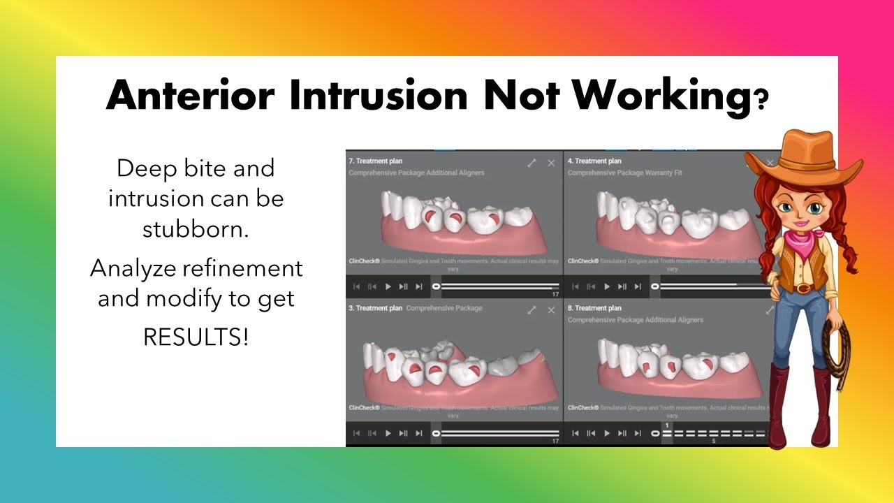 Invisalign ClinCheck - Anterior Intrusion Refinement (additional ...