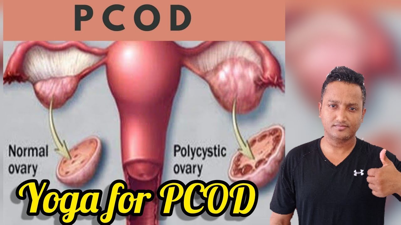 7 Best Yoga Asanas for Relief PCOD & PCOS Problem Permanently 👍👍 Yoga ...