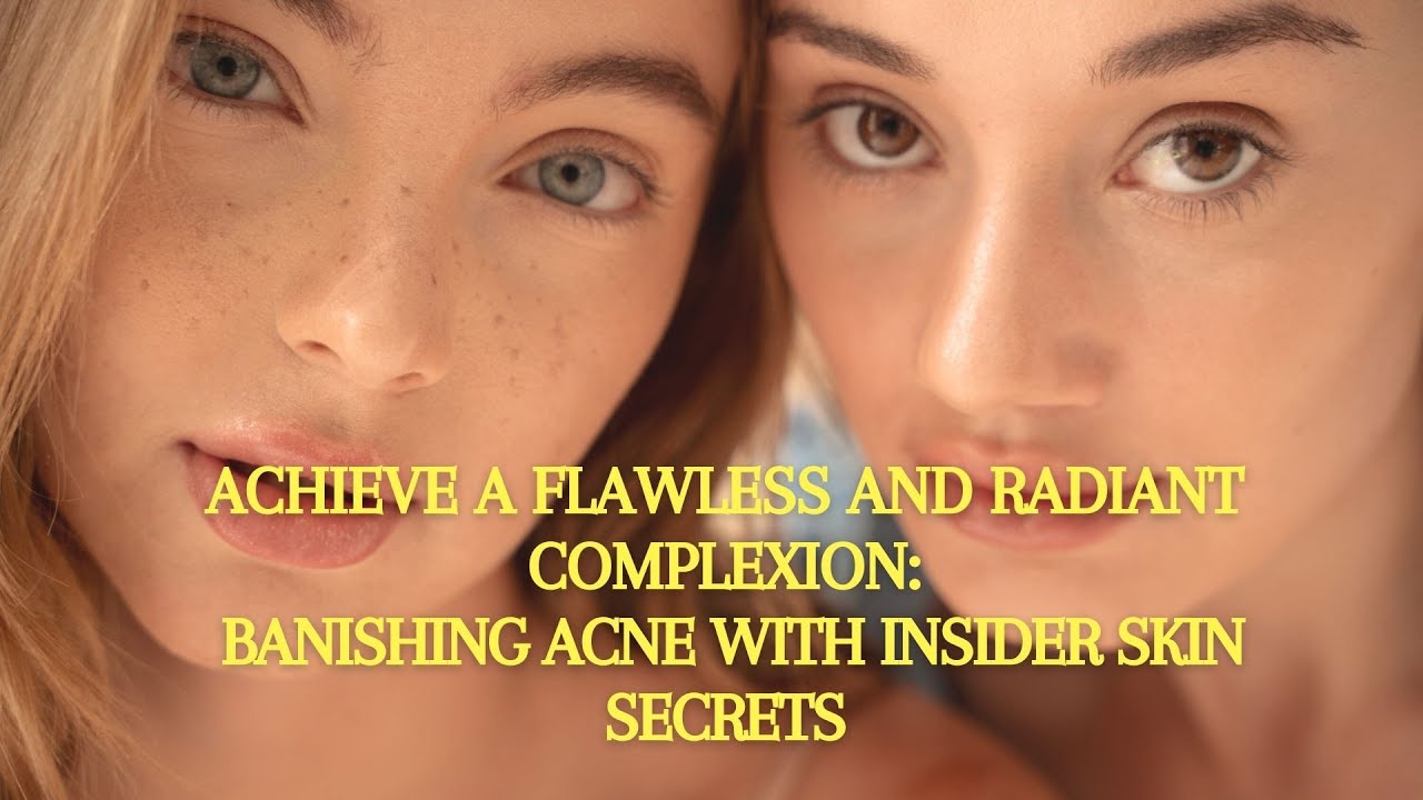 Achieve a Flawless and Radiant Complexion: Banishing Acne with Insider ...
