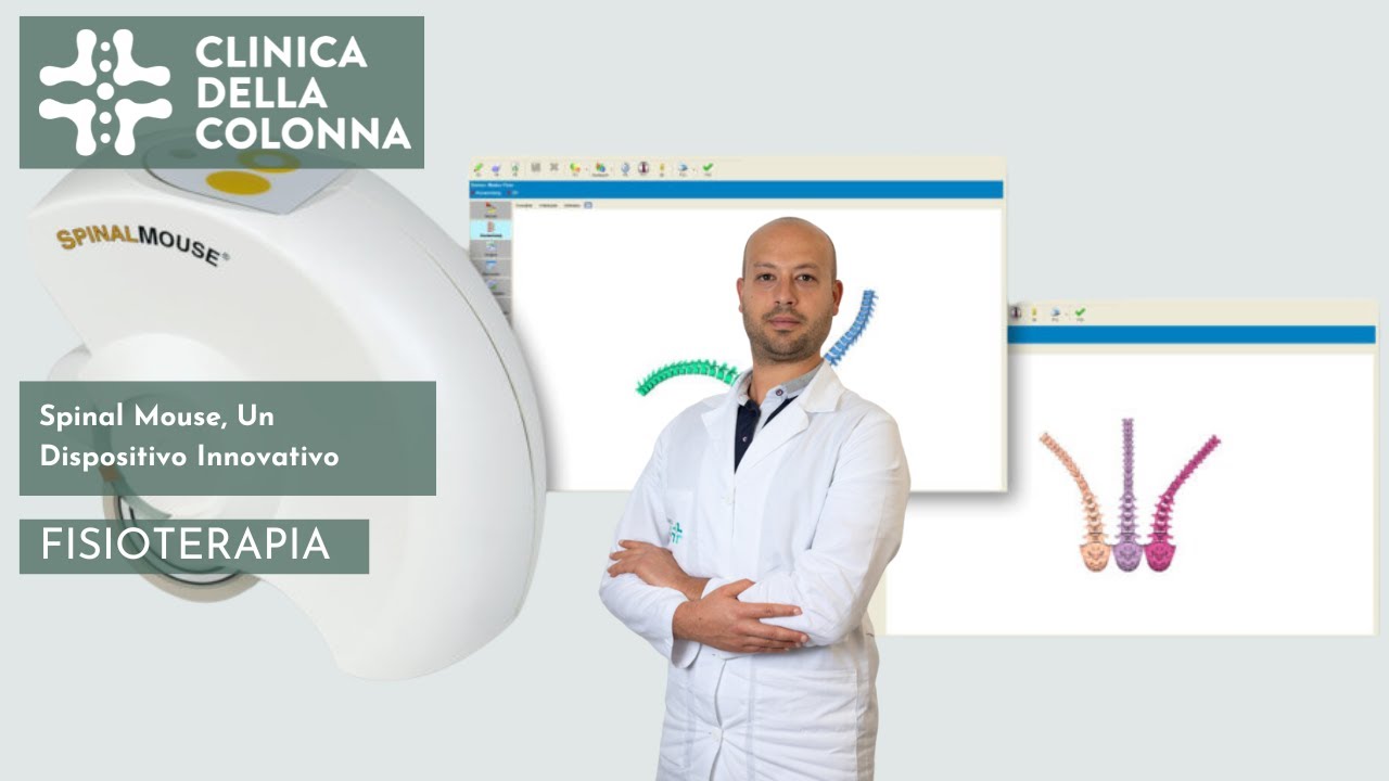 Spinal Mouse, un dispositivo innovativo - YouTube
