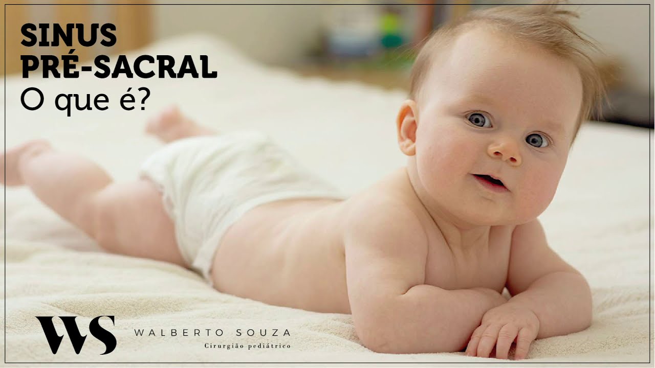 O QUE É SINUS PRÉ-SACRAL? - YouTube