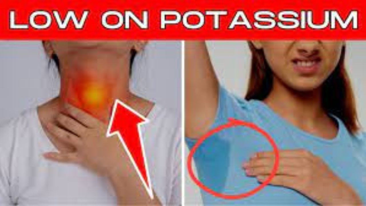 9 Signs You Might Be Low on Potassium | Symptoms & Solutions - YouTube