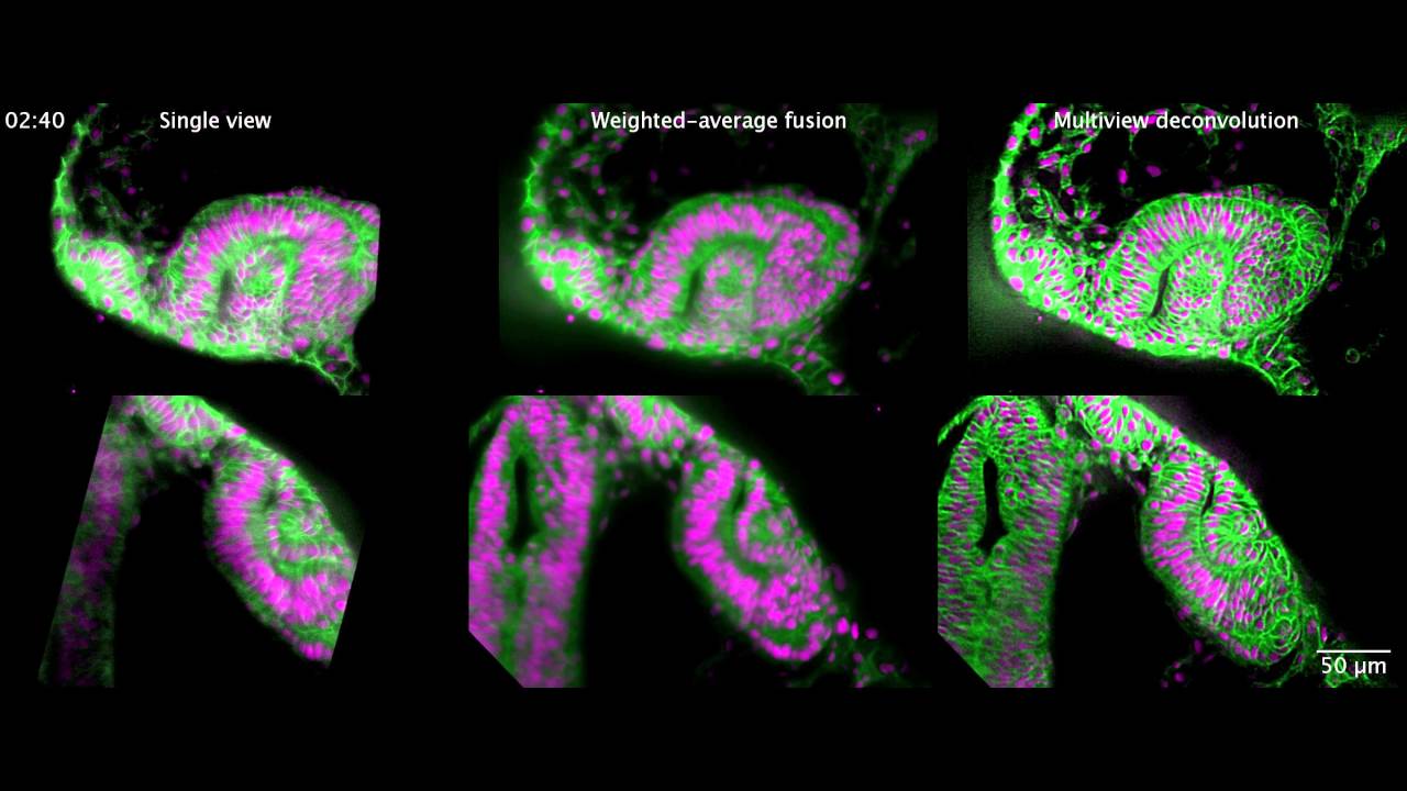 Light sheet imaging: zebrafish optic cup morphogenesis - YouTube