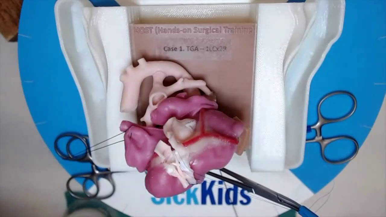 Arterial switch operation on silicone model of TGA 1LCx2R (Dr D Barron ...