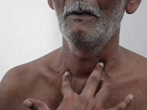 Tracheal palpation - Insinuation method (video only) - YouTube