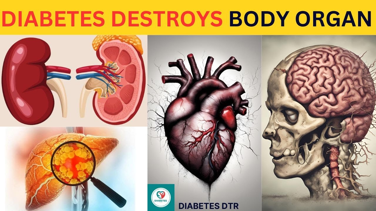 How Are Your Body Organs Affected by Diabetes? - YouTube