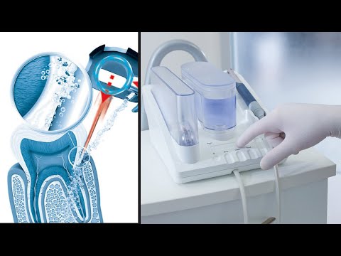 Vector Paro & Vector Scaler | Dürr Dental (Германия) - YouTube