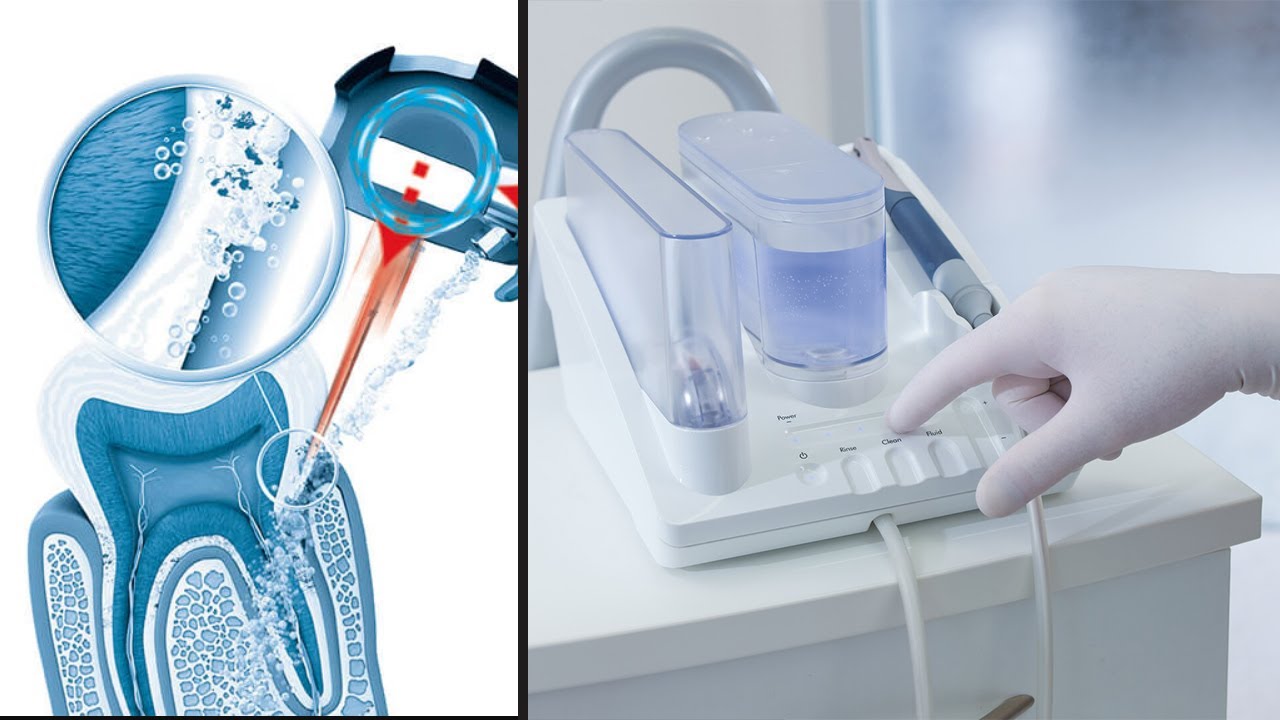 Vector Paro & Vector Scaler | Dürr Dental (Германия) - YouTube