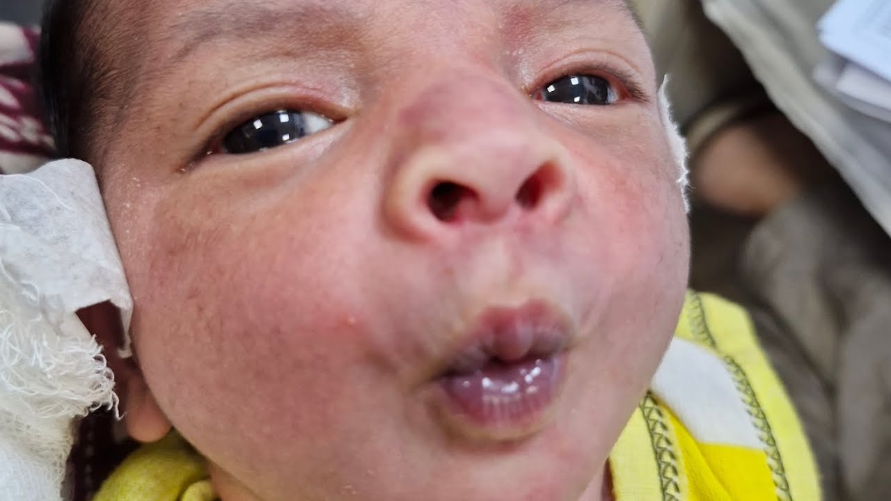 learn to make Indigenous cpap!! #cpaptherapy #cpap #Indigenouscpap ...