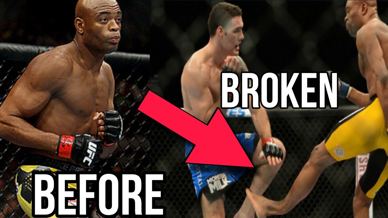 UFC WORST MOMENTS (BROKEN BONES) INJURIES - YouTube
