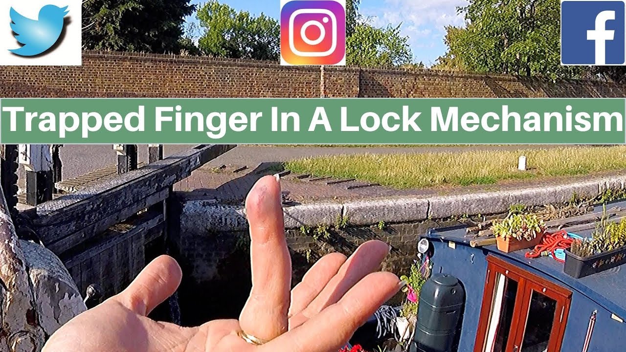 #60 - Trapped Finger In A Lock Mechanism - YouTube