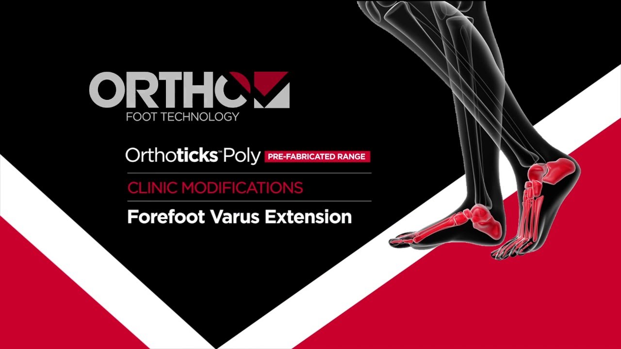 Orthoticks Poly:: Customisations - Forefoot Varus Extension - YouTube