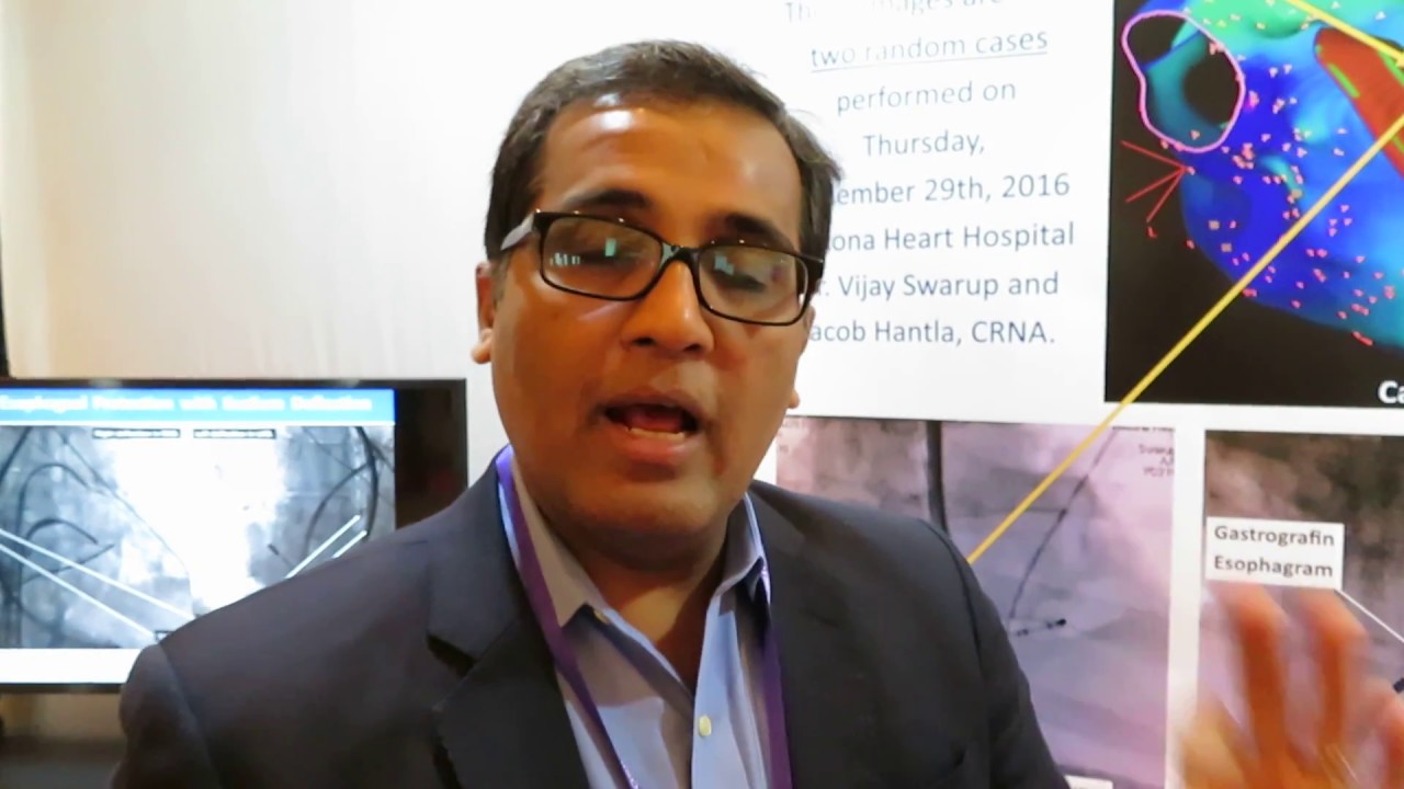 EsoSure Interview with Dr. Dhanunjaya Lakkireddy, MD, FACC, FHRS - YouTube