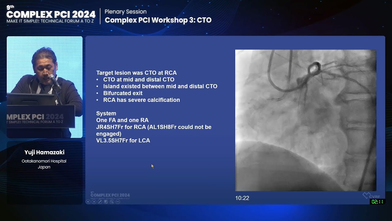 [COMPLEX PCI 2024] Complex PCI Workshop 3: CTO - YouTube