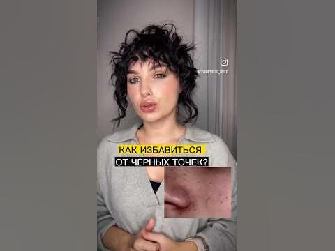 ЧТО ПОМОГАЕТ ОТ ЧЕРНЫХ ТОЧЕК? #прыщи #черныеточки #косметолог - YouTube