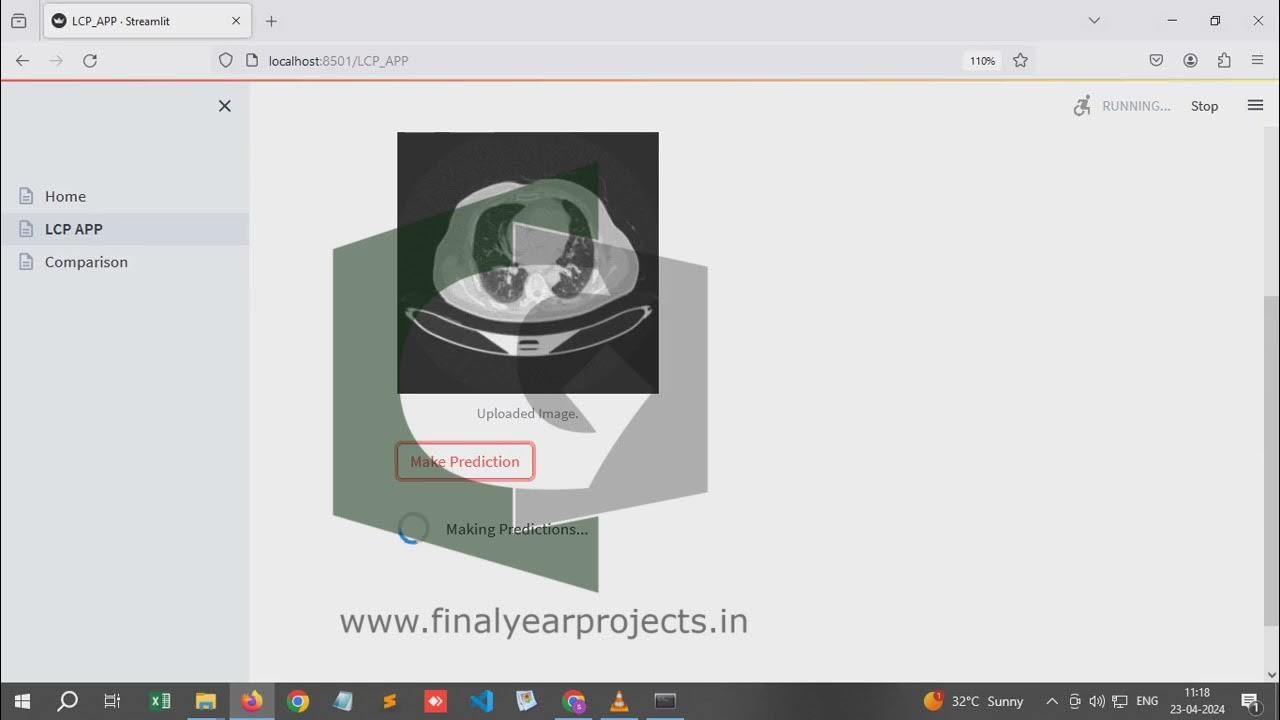 LCDctCNN: Lung Cancer Diagnosis of CT scan Images Using CNN Based Model ...