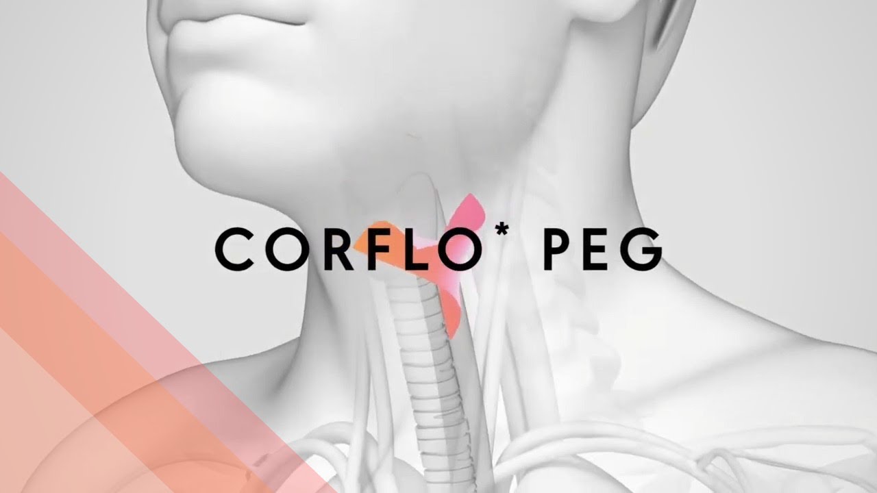 CORFLO PEG Sonde - YouTube