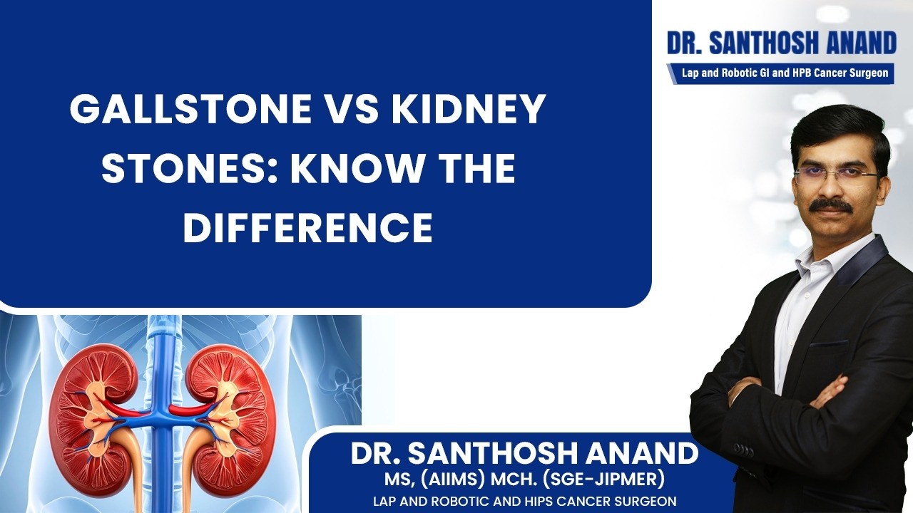Gallbladder Stones vs Kidney Stones | #DrSanthoshAnand # ...