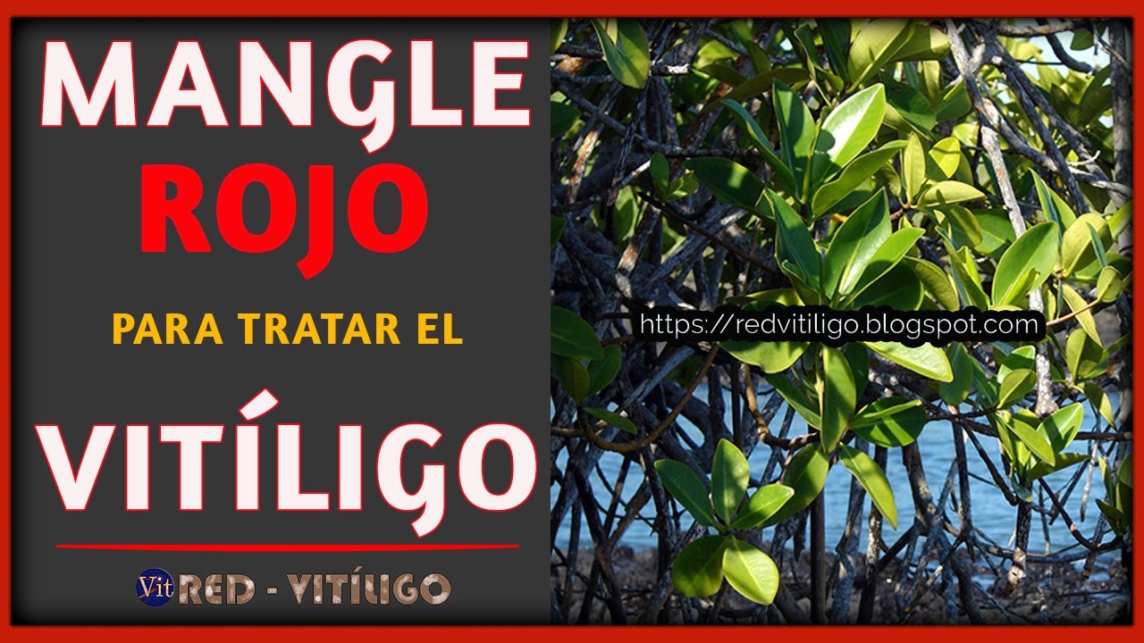 🍃Mangle Rojo Sirve Para Curar El Vitiligo │Beneficios y Propiedades.🍃 ...