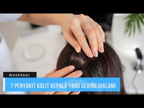 Waspadai - 7 Penyakit Kulit Kepala yang sering di alami