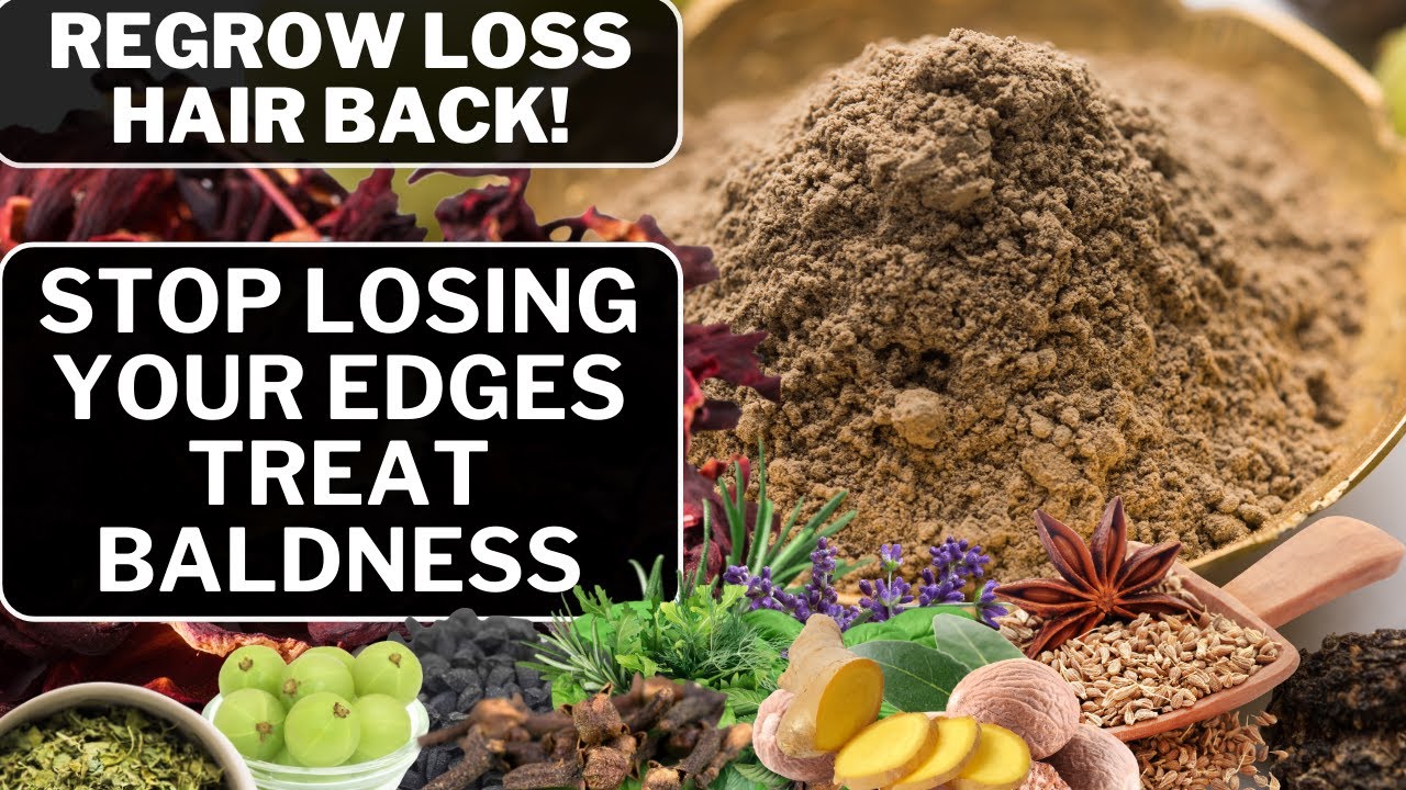 BALD PATCHES GROW FASTER - EDGES & RECEDING HAIR LINE - INCREASE ...