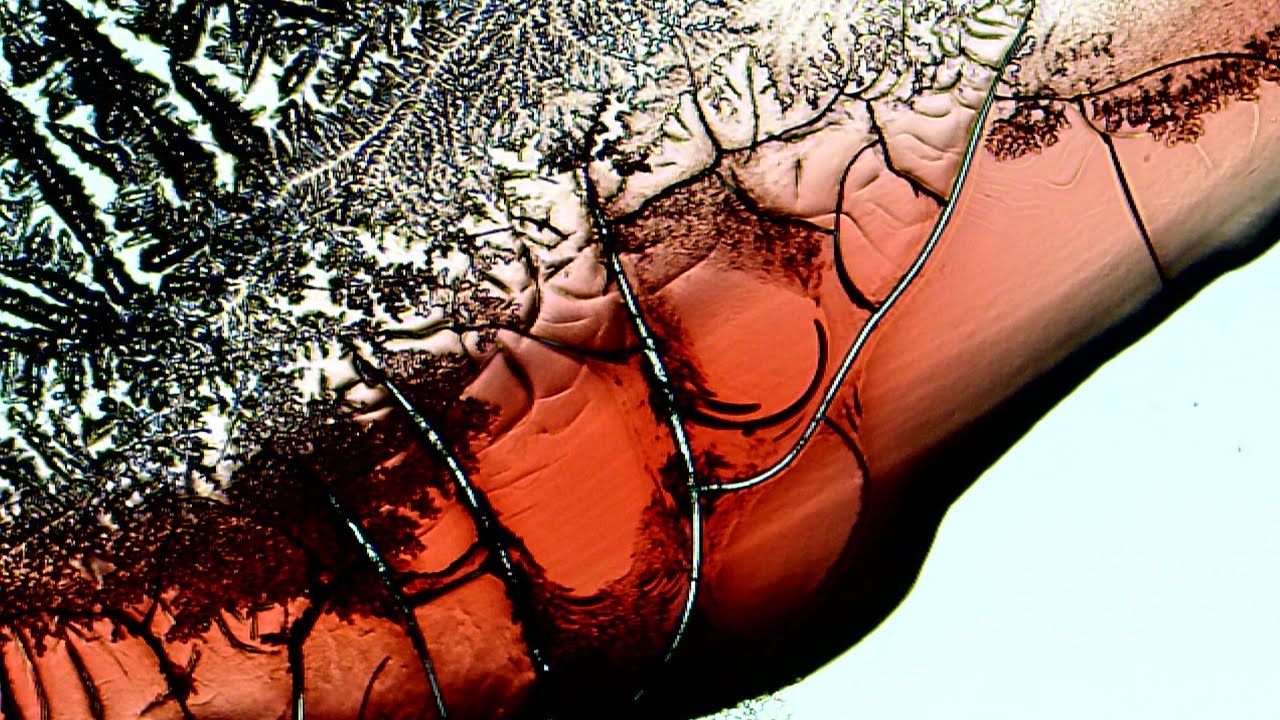 Under a Microscope blood vs. saline crystals explosion crystallization ...