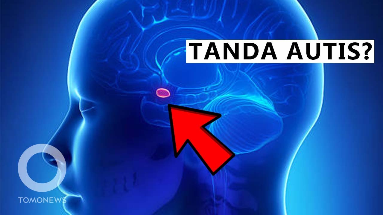 Autisme: Bagian Otak Ini Tumbuh Terlalu Cepat Pada Bayi ASD - YouTube
