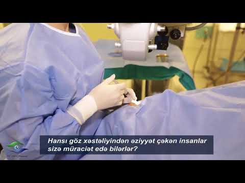 Bu göz xəstəlikləri üçün Oftalmoloq Uzman Dr. Zöhrə Məsiyevaya müraciət edə bilərsiniz.